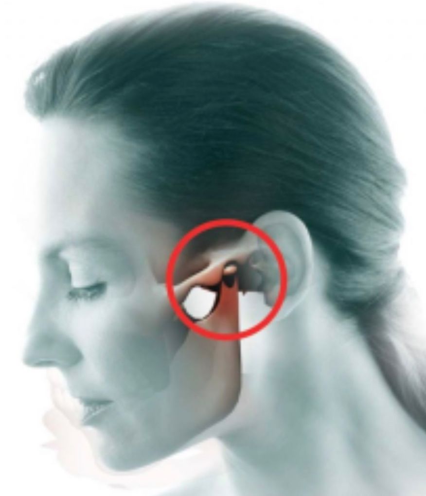 Temporomandibular Joint (TMJ) Disorder Department - MiralDental